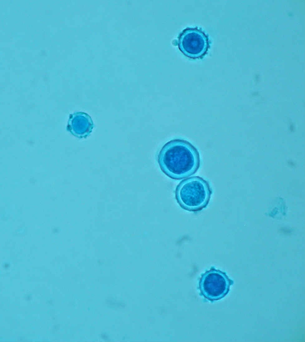 ATLAS MICOLOGIA: CONIDIOBOLUS CORONATUS