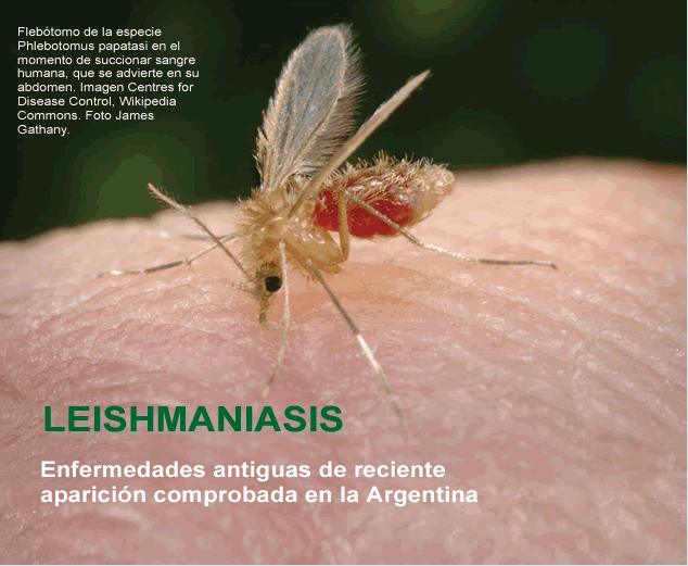 la leishmaniasis