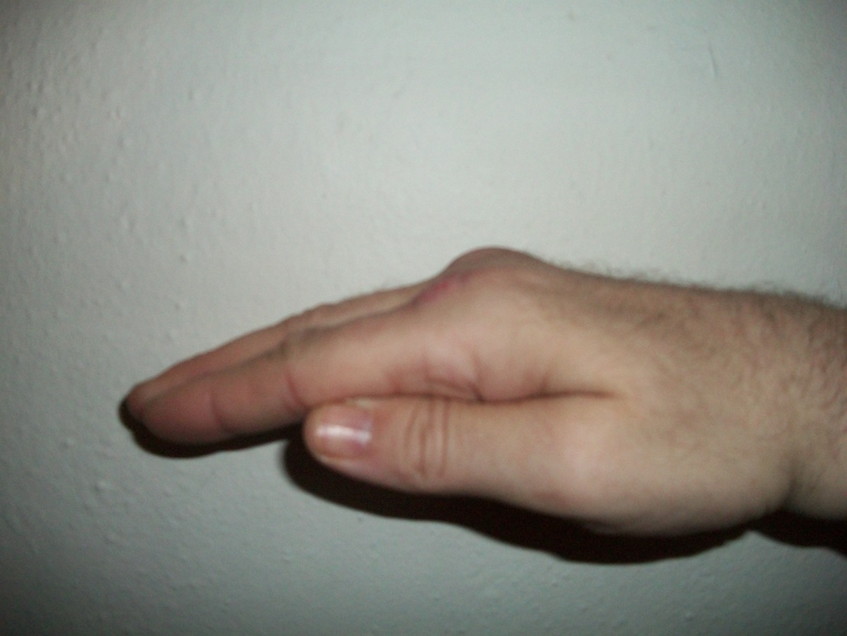Ryukyu Martial Arts: Small Surface Strikes & Structural Support