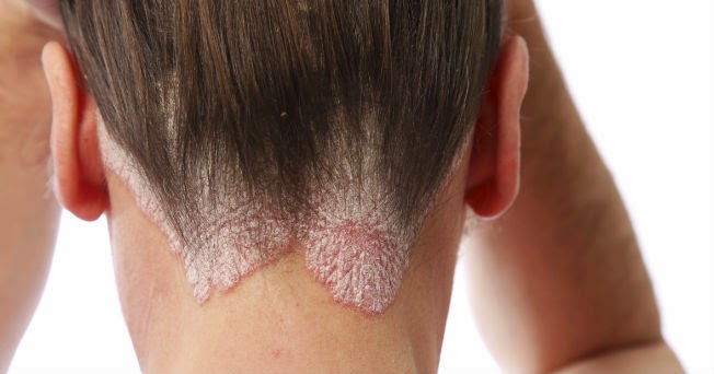 Medicina Natural: La manera más facil y efectiva de prevenir y combatir ...