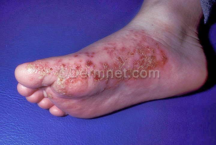 El blog de jocassan: Medicina