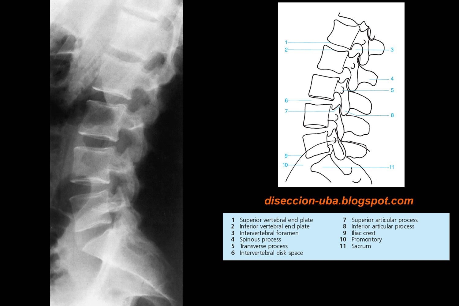 rx: Rx columna lumbar lateral