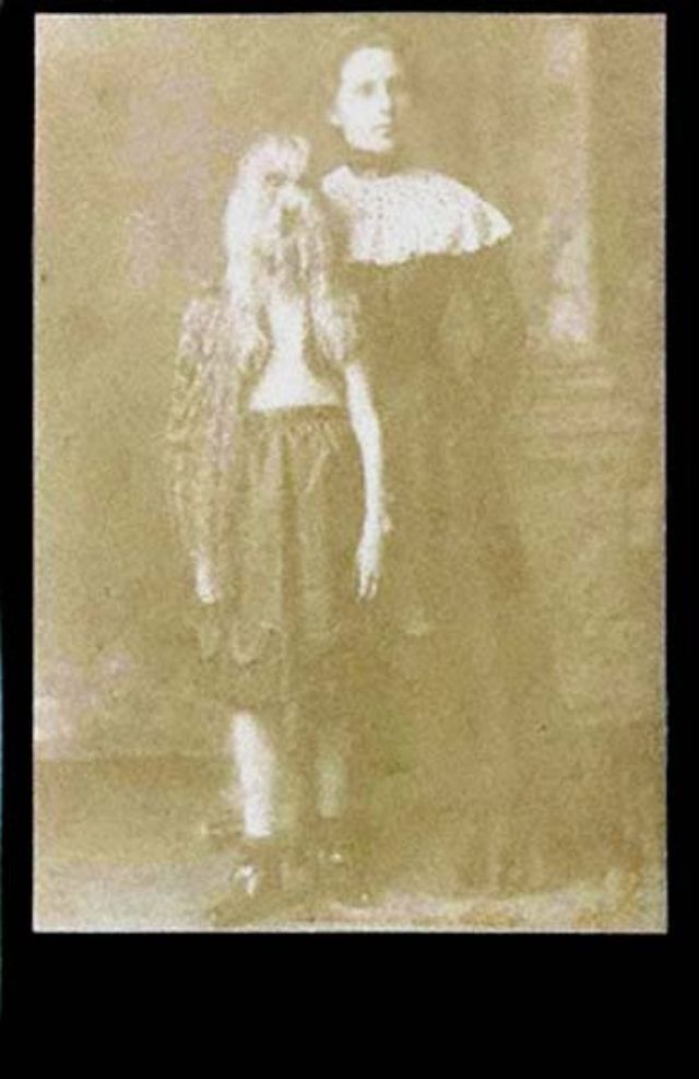 Amazing Vintage Photographs of the 'Minnesota Woolly Girl' Alice ...