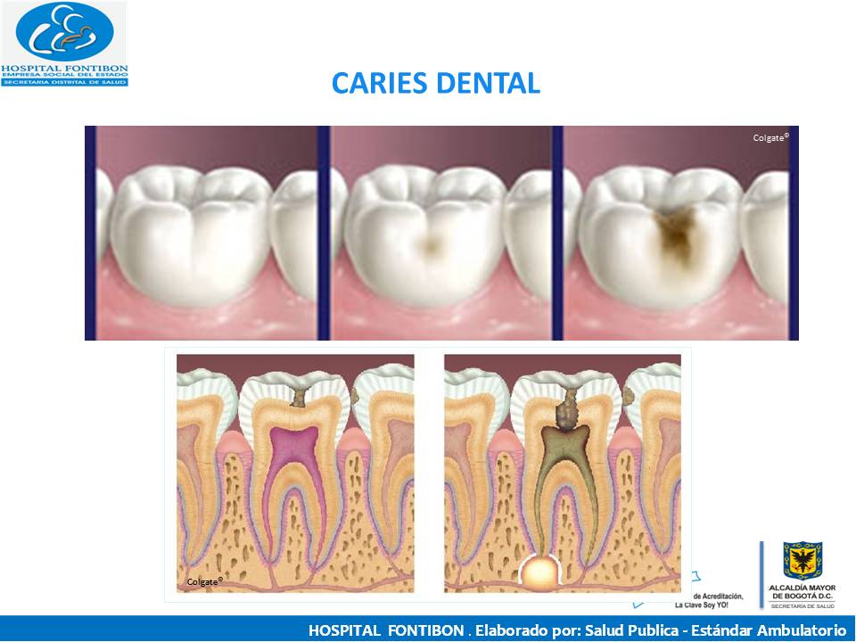 Ambito IPS: ROTAFOLIO DE SALUD ORAL