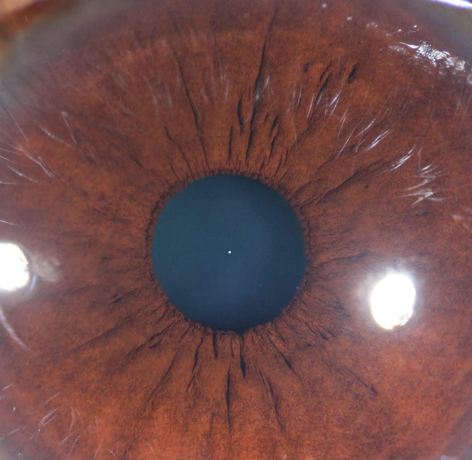 Modern & Multidimensional Iridology: IPB Morphologies, Pupil Flattening ...