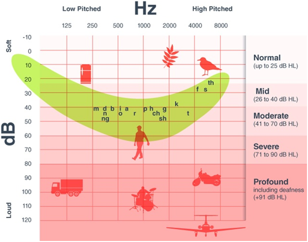 Derajat Gangguan Pendengaran ~ Alat Bantu Dengar Murah