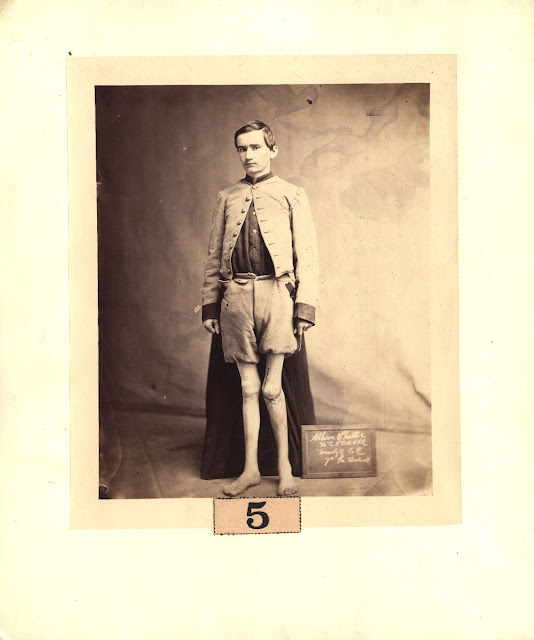 Eerie Vintage Portraits of Wounded Soldiers During the American Civil ...
