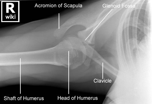 ON - RADIOLOGY: Radiographic anatomy of Paediatric Shoulder