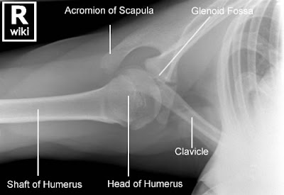 ON - RADIOLOGY: Radiographic anatomy of Paediatric Shoulder