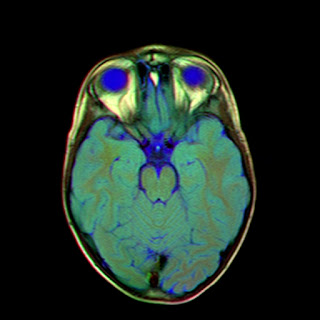 Nevit's blog: Color MRI of the Brain