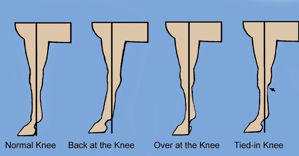 CONFORMATION FAULT: Three Common Knee Problems