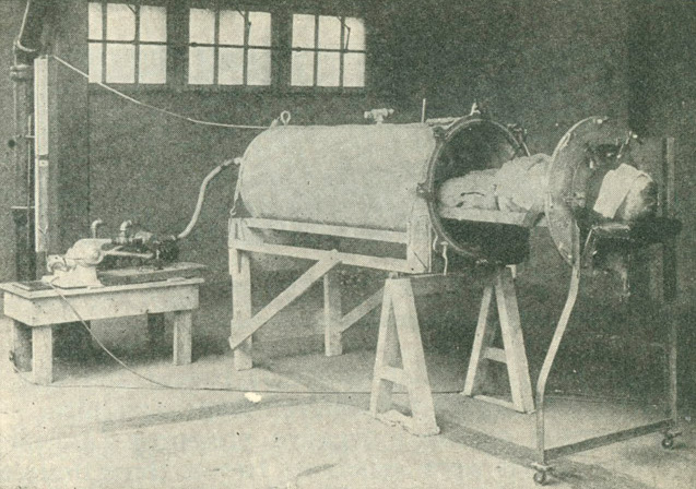 On Day History: On this day in history: Iron lung used for first time, 1928