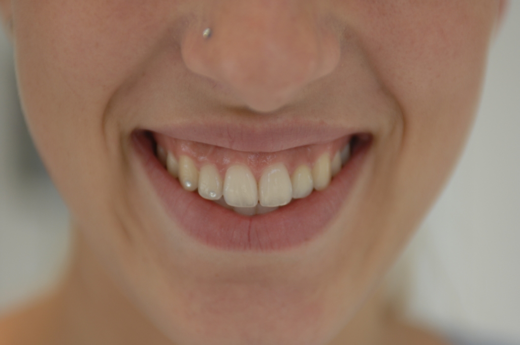 FRENKENKLINIK: Beitrag 130 aus der FRENKENKLINIK: Die Aufgaben des Mundes