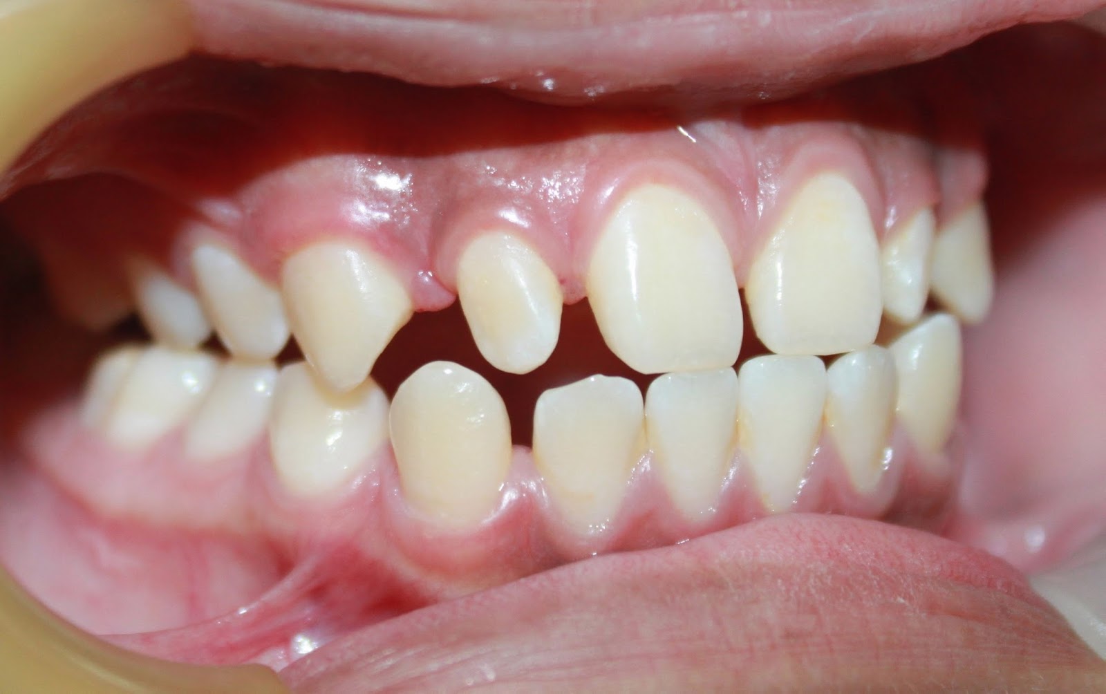 Smiles of San Marcos