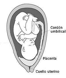 The Well-Rounded Mama: Placenta Previa and Prior Cesarean