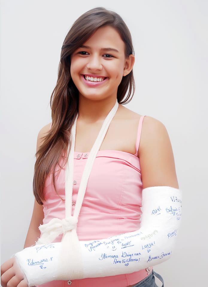 Cyber Arm Cast: Brazil lac cast I