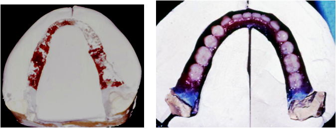 Dentistry and Medicine: Concept of Neutral Zone