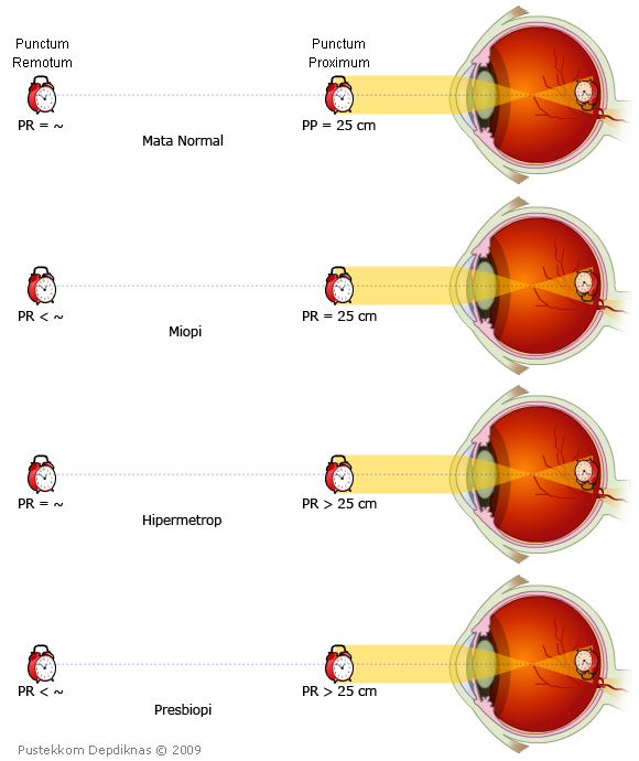 Materi Belajar Tentang Alat Optik Mata - Smansatuja