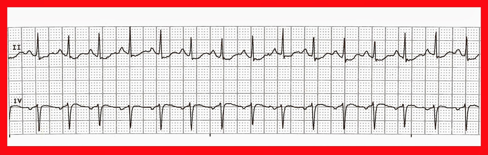 Practice EKG Strips 407
