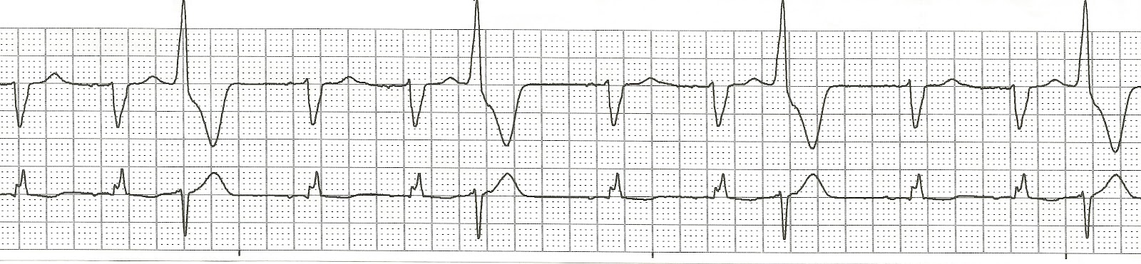 EKG Rhythm Strips 79