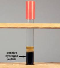 Hydrogen Sulfide (H2S) Production Test - Microbiology Lab Notes