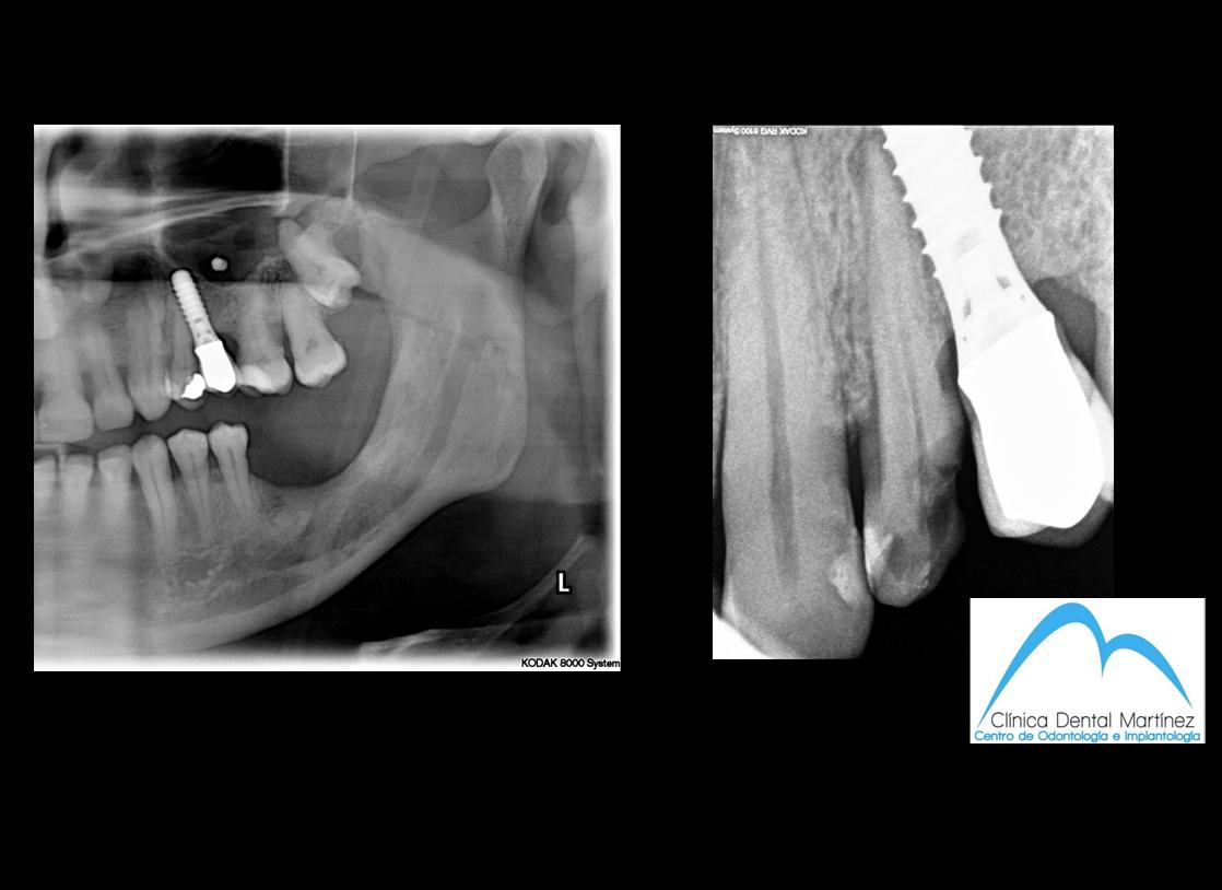 Clínica Dental Martínez