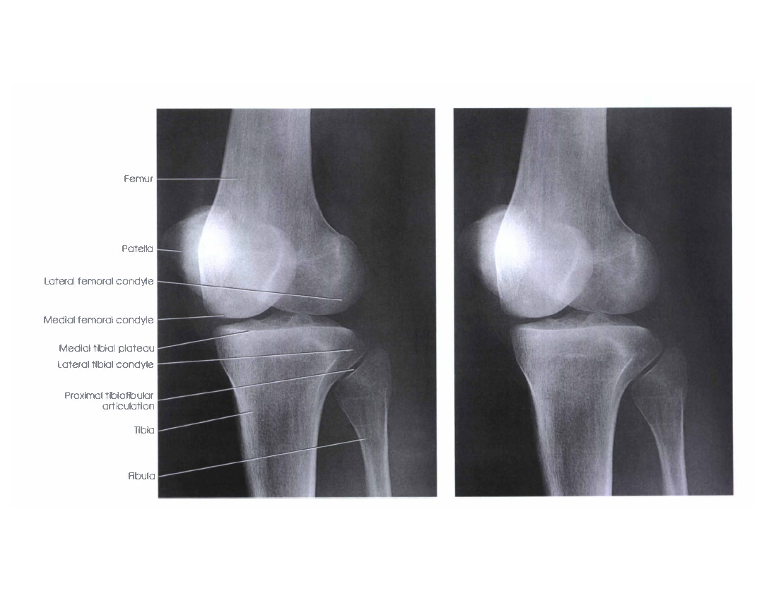 TEKNIK PEMERIKSAAN KNEE JOINT