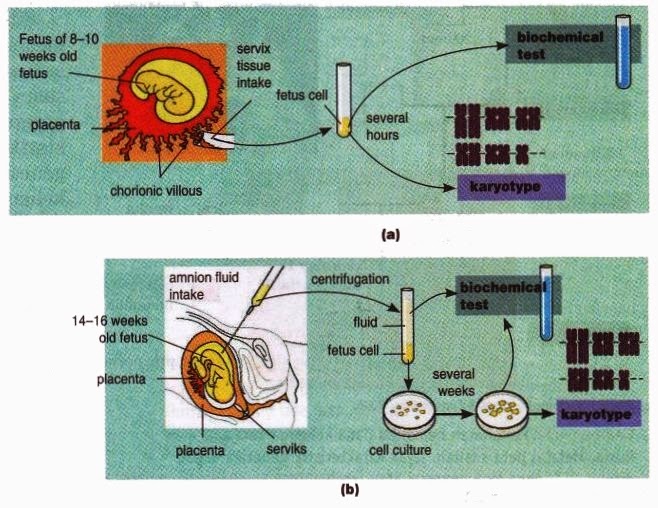 Human Genetic Disorder Procedure Test - New Science Biology