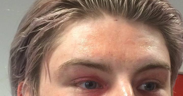 Gothic Horror: Sweat, fever, tears rashes and black eye