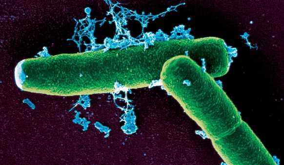 Antraz, Bacillus Anthracis (Anthrax)