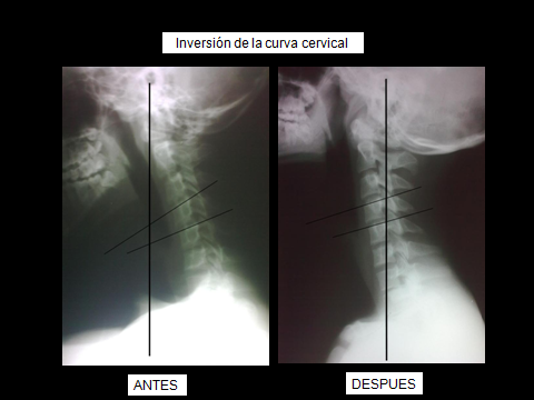 Ignacio Sotelino. Lic. Kinesiólogo Fisiatra - RPG: Casos Clínicos
