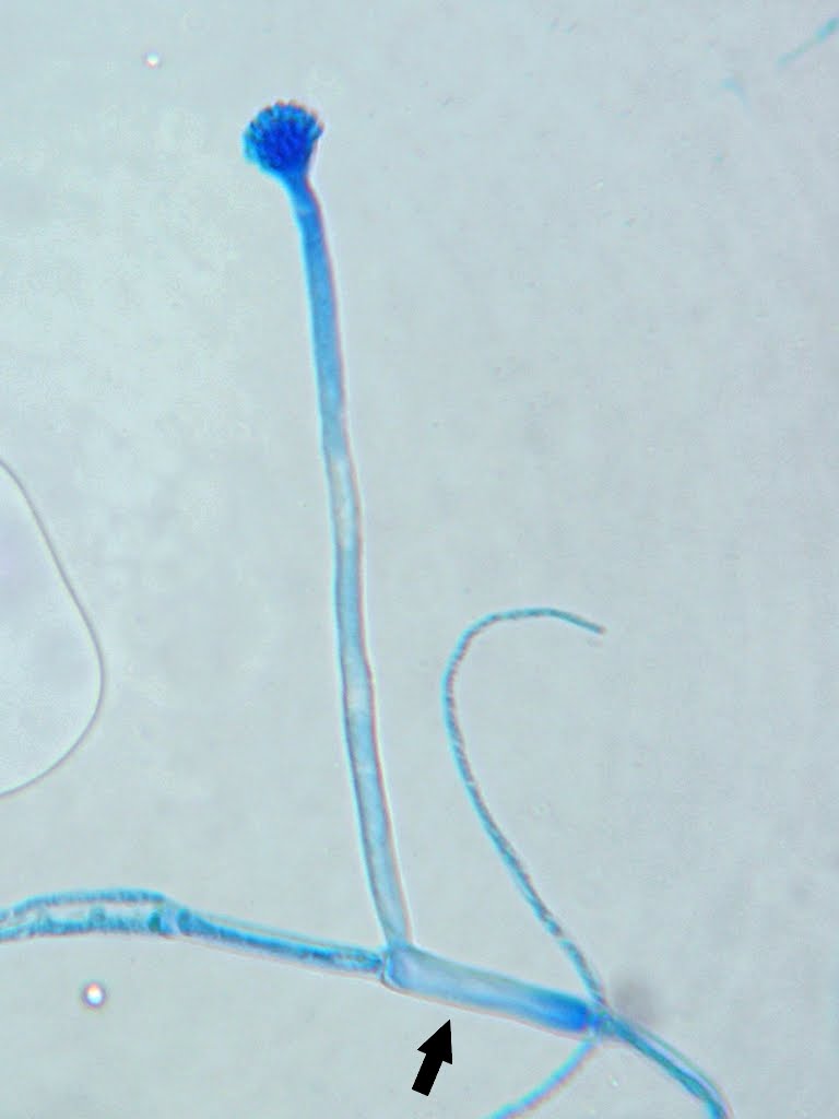 Fun With Microbiology (What's Buggin' You?): Aspergillus species Foot Cell