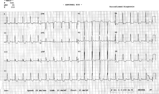 ECG Cold Read Challenge | EMTLIFE