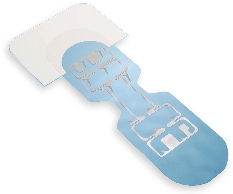 Digital Health : microMend: A novel way to mend the wound after surgery