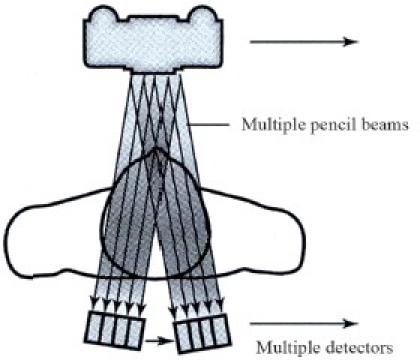 CROSS-SECTIONAL IMAGING EDUCATION HUB: GENERATIONS OF CT SCANNERS