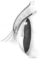 TYWKIWDBI ("Tai-Wiki-Widbee"): Elizabeth Taylor had distichiasis