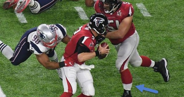 Pro Football Journal: Players with Broken Legs Are 0-4 in Super Bowls