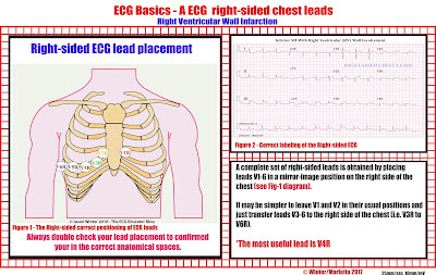 ECG Educator Blog
