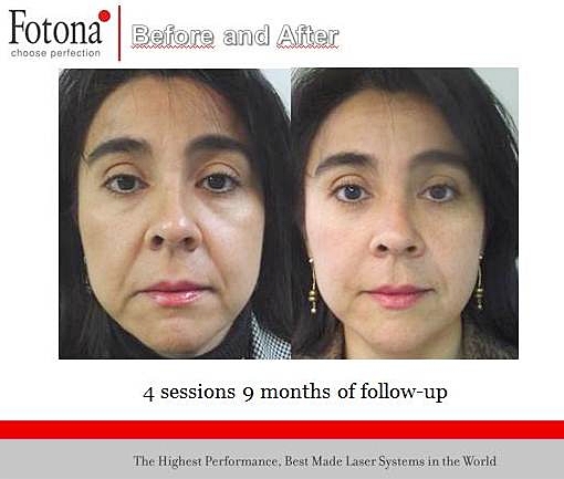 Sunshine Kelly | Beauty . Fashion . Lifestyle . Travel . Fitness ...