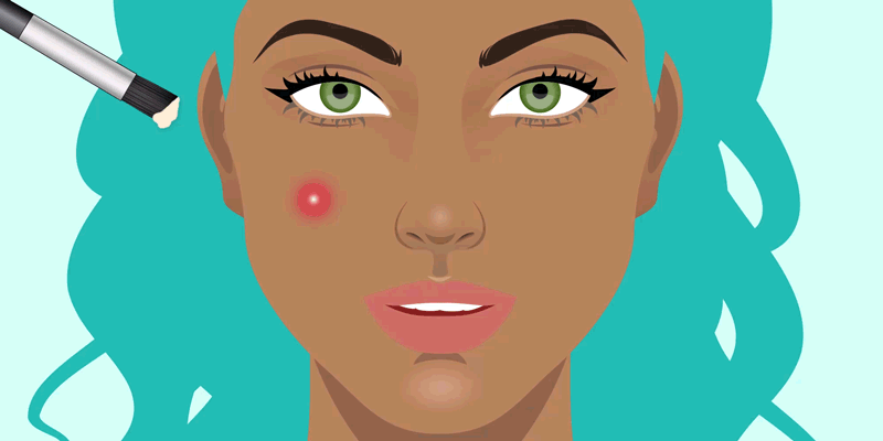 home remedies for pimples: Remedies to Remove Acne Scars