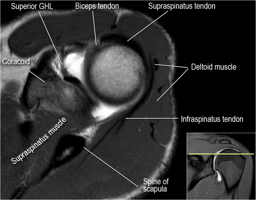 MRI Musculo-Skeletal Section: Axial view check list.