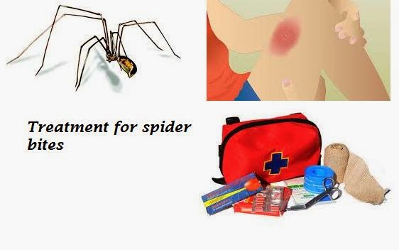 HOW TO RECOGNIZE AND TREAT A SPIDER BITE - Home Remedies Spiders