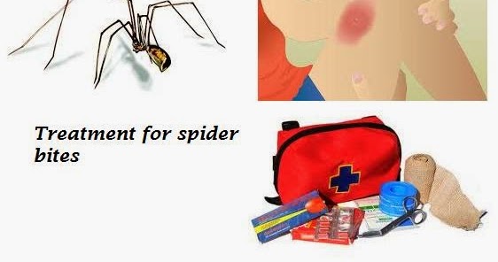 HOW TO RECOGNIZE AND TREAT A SPIDER BITE - Home Remedies Spiders