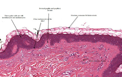 Dermatopathology Made Simple - Inflammatory: Introduction to skin ...