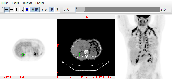 その動作環境はFijiが推奨されているようです。 以降はFijiで動作を紹介します。