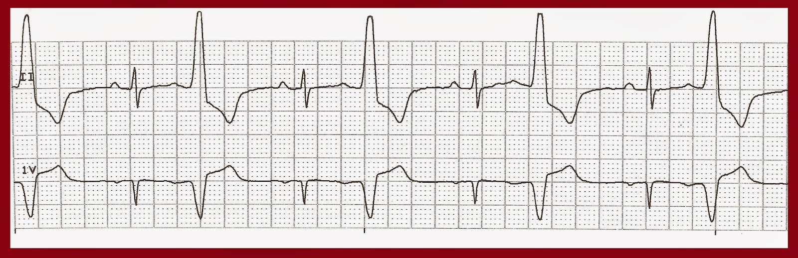 Float Nurse: November 2014