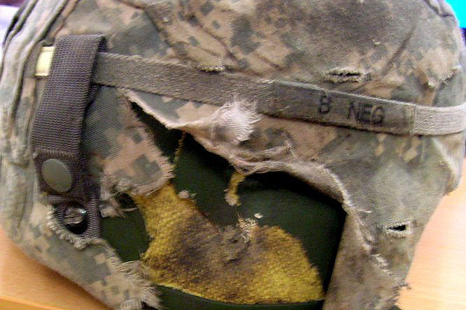 TBI combat Injury: What is TRAUMATIC BRAIN INJURY 6-18-2015