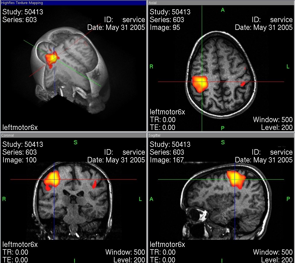 INTRODUCCIÓN A LA RADIOLOGÍA: RESONANCIA MAGNÉTICA NUCLEAR