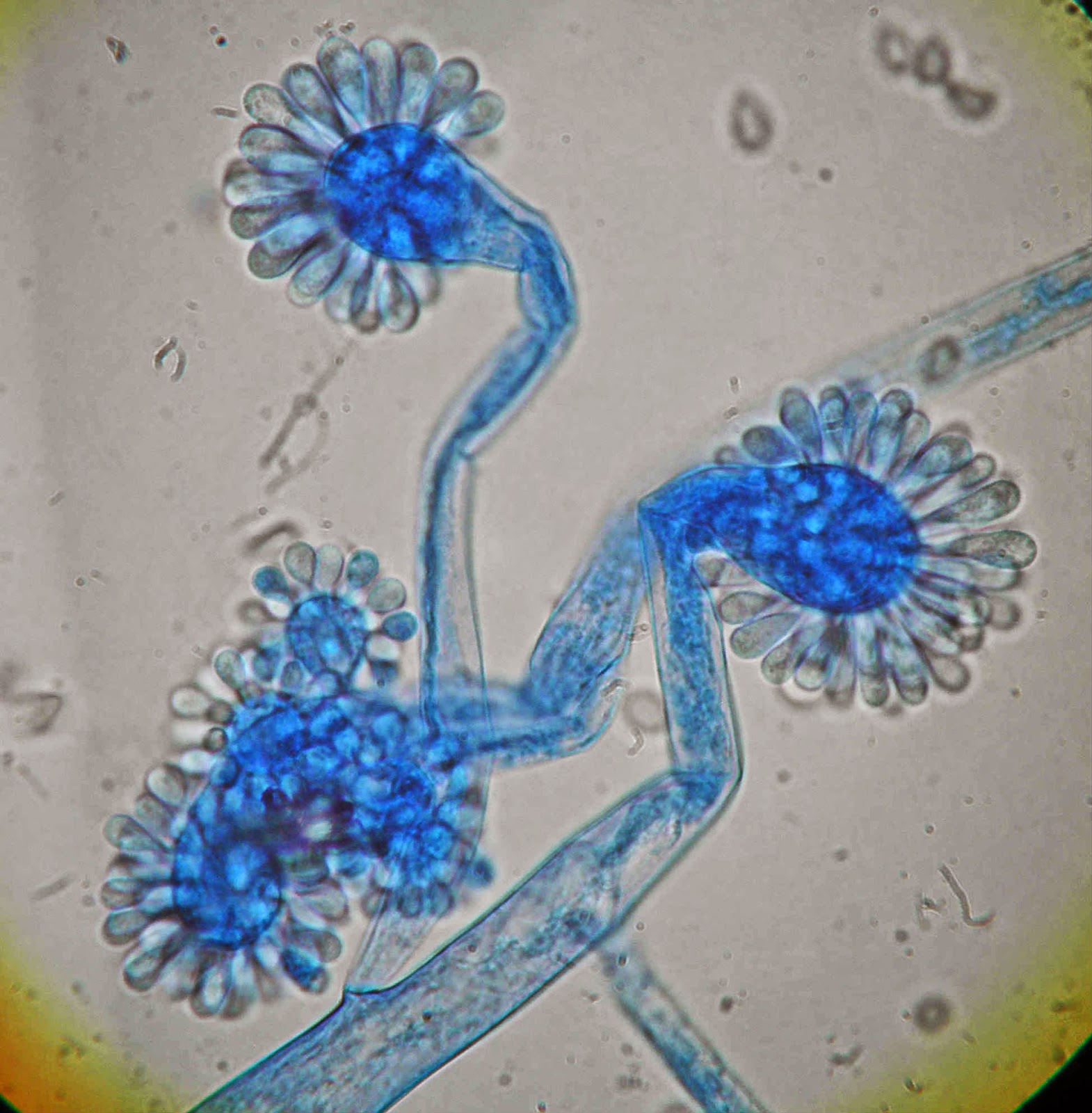 ATLAS MICOLOGIA: CUNNINGHAMELLA BERTHOLLETIAE