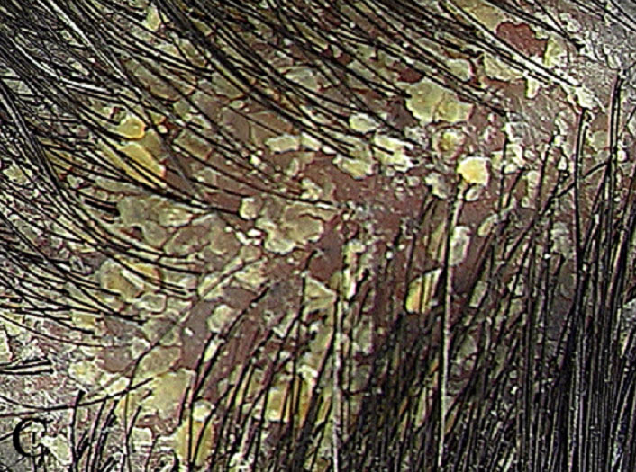 Χειροποίητον